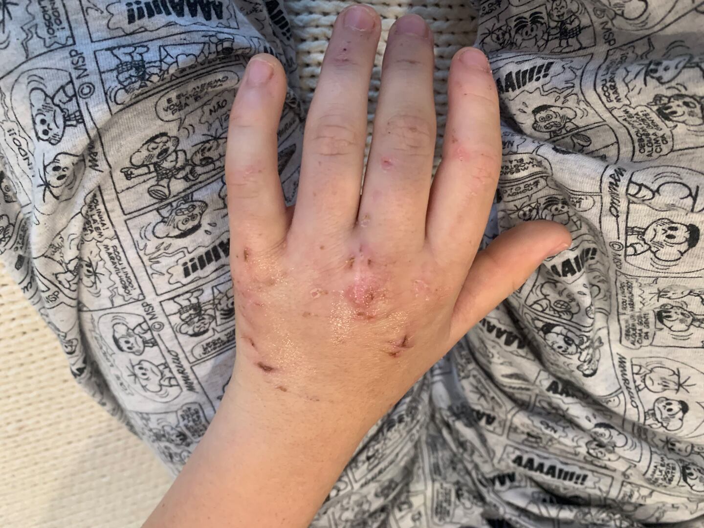«J’ai cru que j’allais mourir»: attaqué par un chien, un jeune de 11 ...