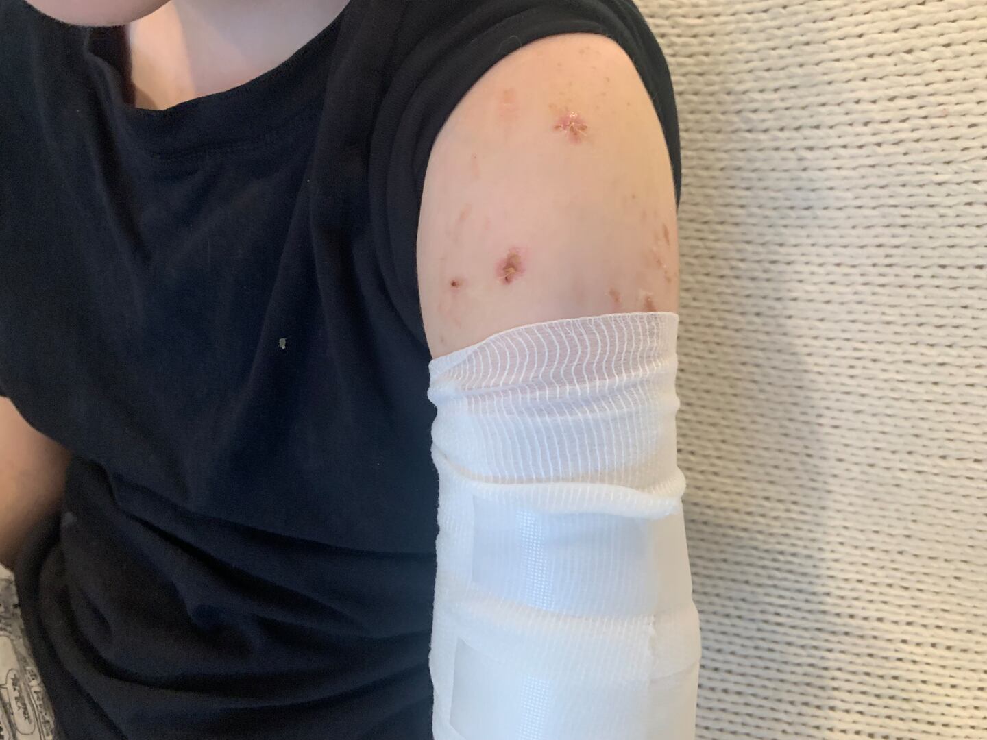 «J’ai cru que j’allais mourir»: attaqué par un chien, un jeune de 11 ...